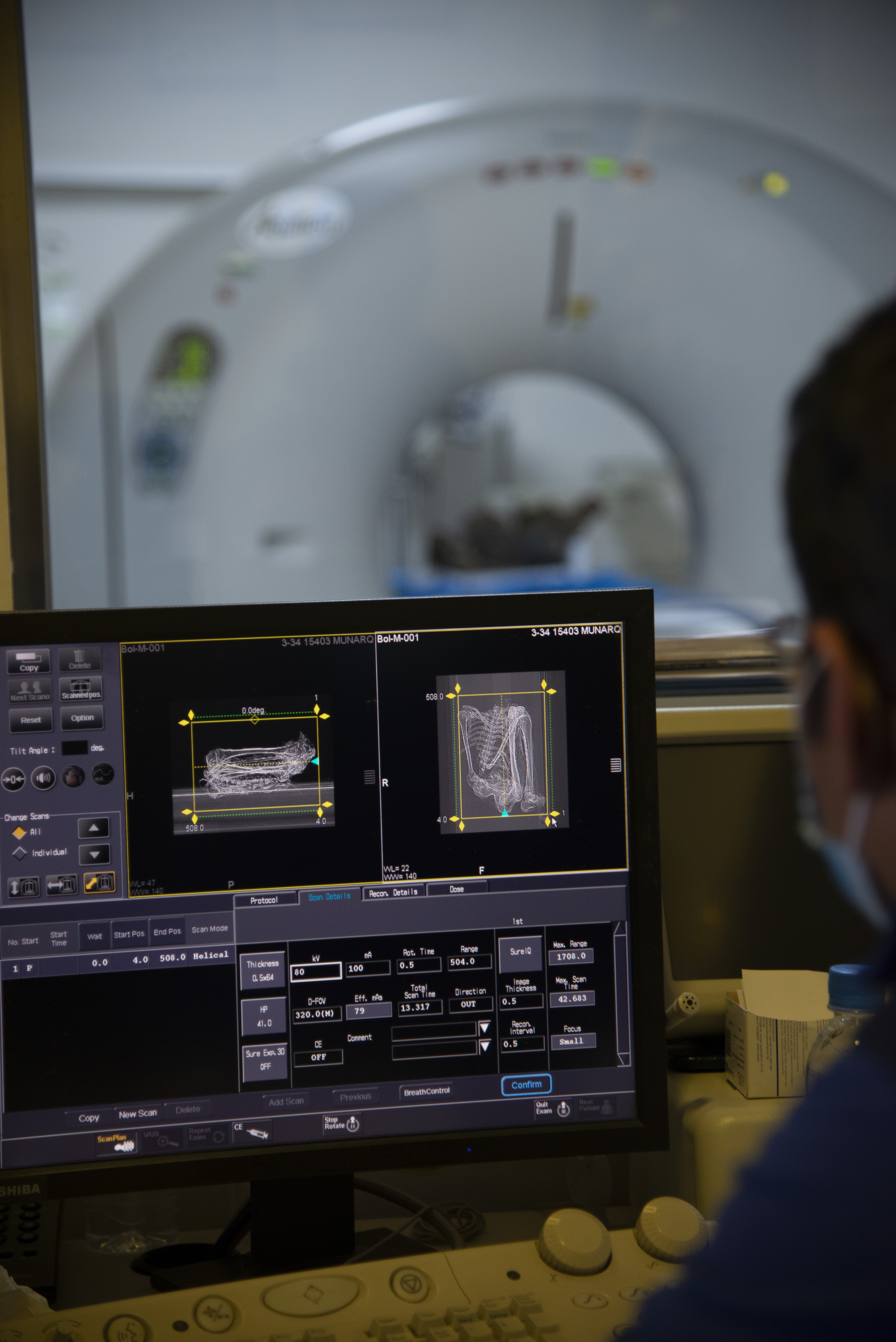 New technology for Bolivia's ancient mummies